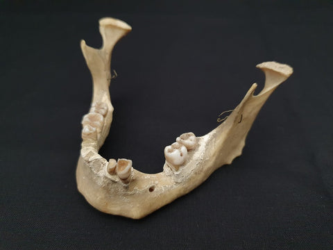 Human bones, skeletons and skulls – The Cabinet of Curiosities