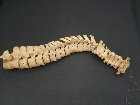 Human bones, skeletons and skulls – The Cabinet of Curiosities