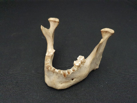 Human bones, skeletons and skulls – The Cabinet of Curiosities