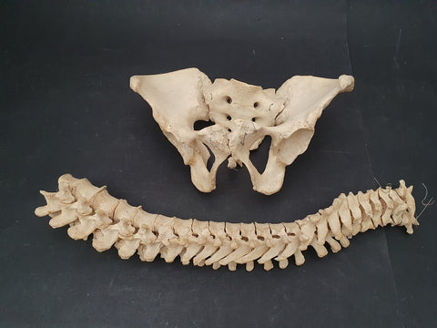 Human bones, skeletons and skulls – The Cabinet of Curiosities